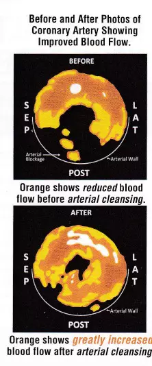 RTRE™ (Cardiovascular Nutrition) | Vitamost | Rowland Formulas